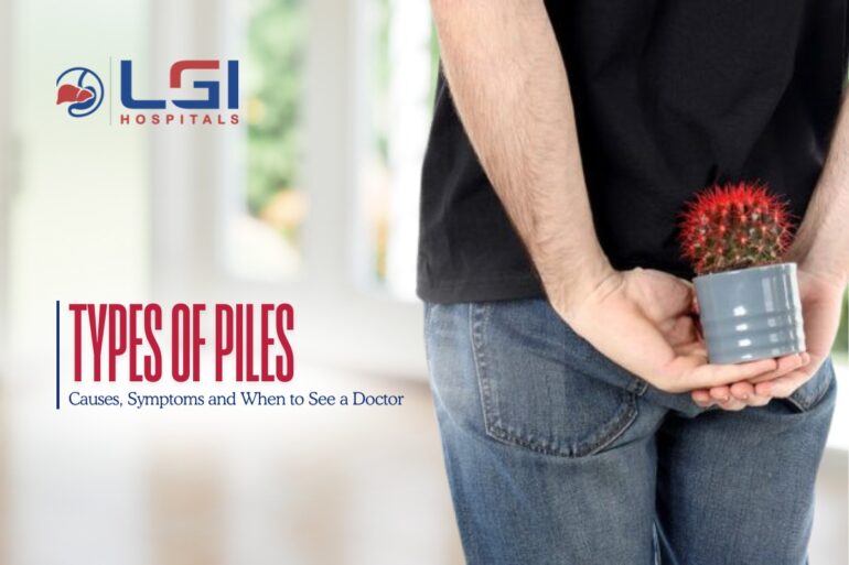Types of Piles: Causes, Symptoms & When to See a Doctor