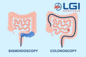 Sigmoidoscopy vs Colonoscopy: Key Differences & Guide