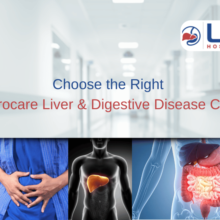 Liver Health and Jaundice: Causes, Symptoms & Treatment