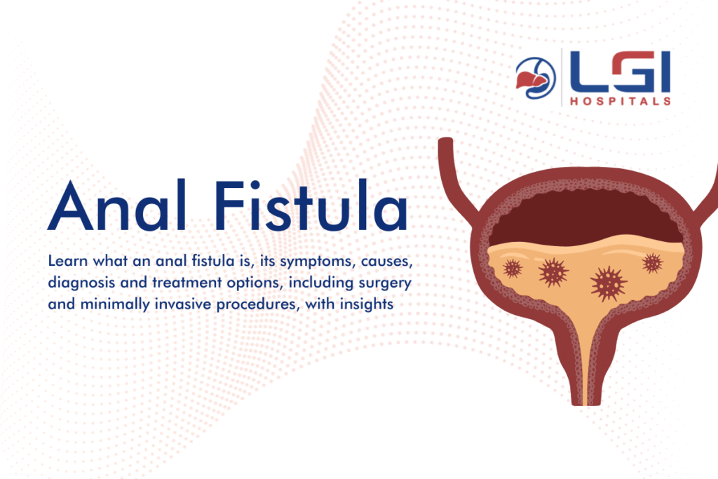 Anal Fistula: Symptoms, Causes, Diagnosis and Treatment Options